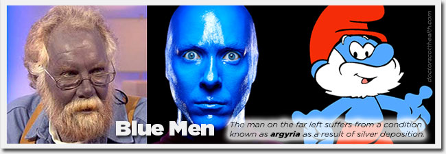 Blue-Men-Argyria-Silver-Skin-Deposits-Pigmentation-650-drop - Doctor ...