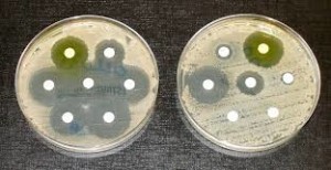 Antibiotic Discs in Petri Dishes - Doctor Scott Health Blog
