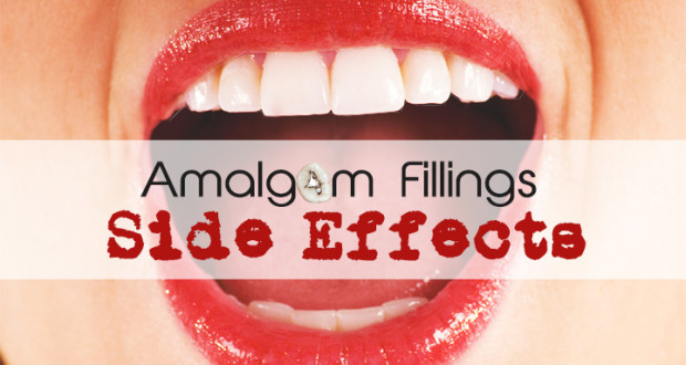 Amalgam Fillings Side Effects - Doctor Scott Health Blog